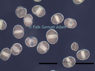 Microscope World Blog: Cedar Pollen Under the Microscope