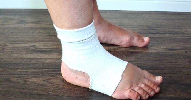 Kidner Procedure Definition, Recovery, Rehabilitation, Cost - Health ...