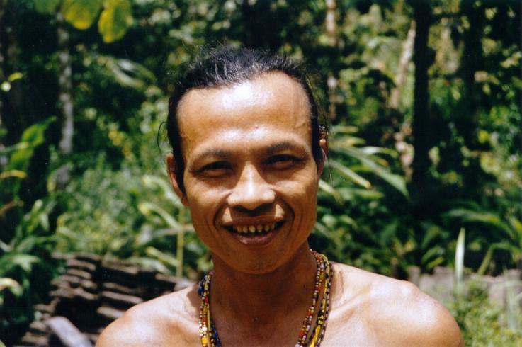 Deformutilation: Sharpened Teeth