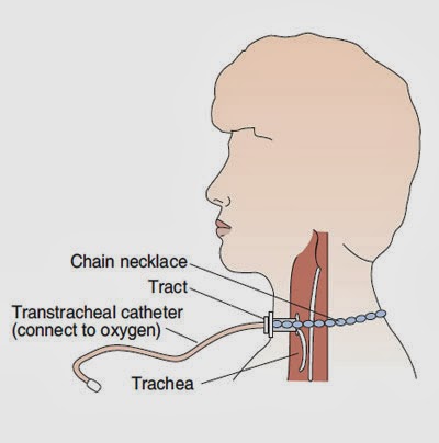 Procedure of Oxygen Delivery Equipment ~ Nursing