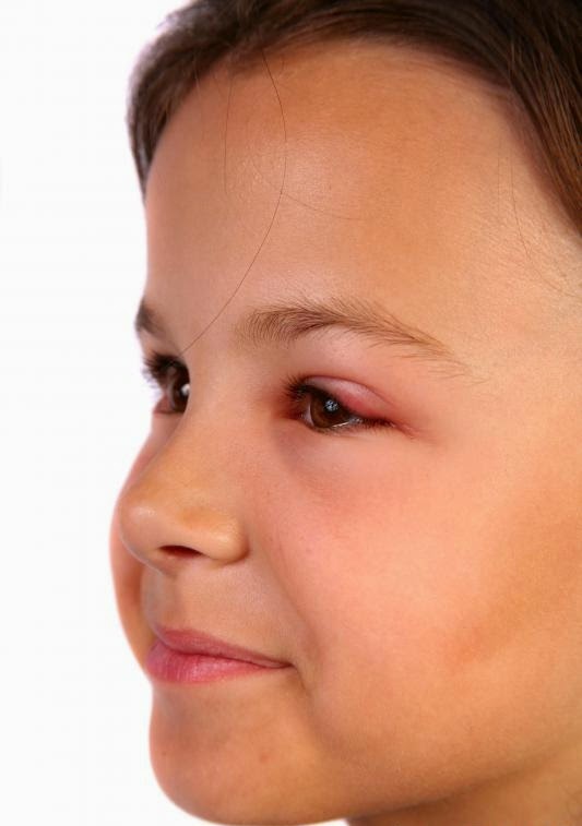 Ce que tu cherche : Quelles sont les causes ordinaires de gonflement ...