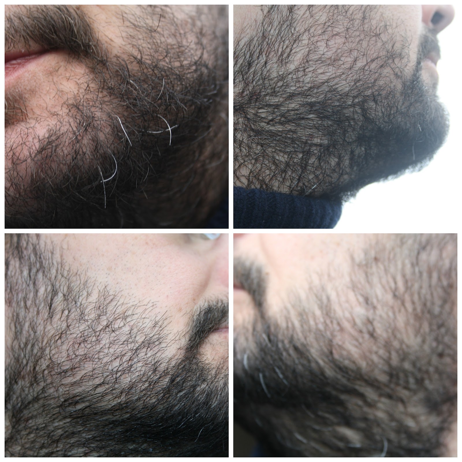 Beautykinguk: Beard Control by Billy Jealousy
