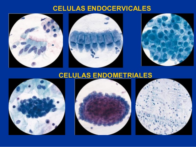Citología Exfoliativa Mérida: Células normales en una prueba de ...