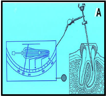 Unicorn Denmart Ltd.: How to use an Apex Locator
