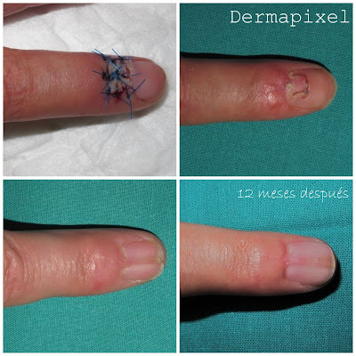 Dermapixel: octubre 2012