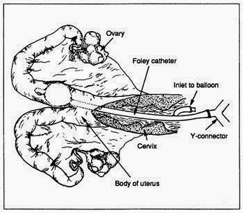 Embrio Transfer (TE), bag 2. - Mydokterhewan