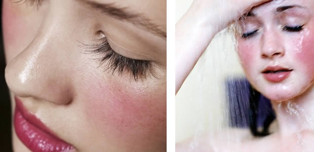 BeautyByAlma: Soins Peaux Sensibles!!!!