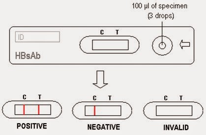 HBsAg False Negative in Rapid Test ~ Medical Technology Bangladesh