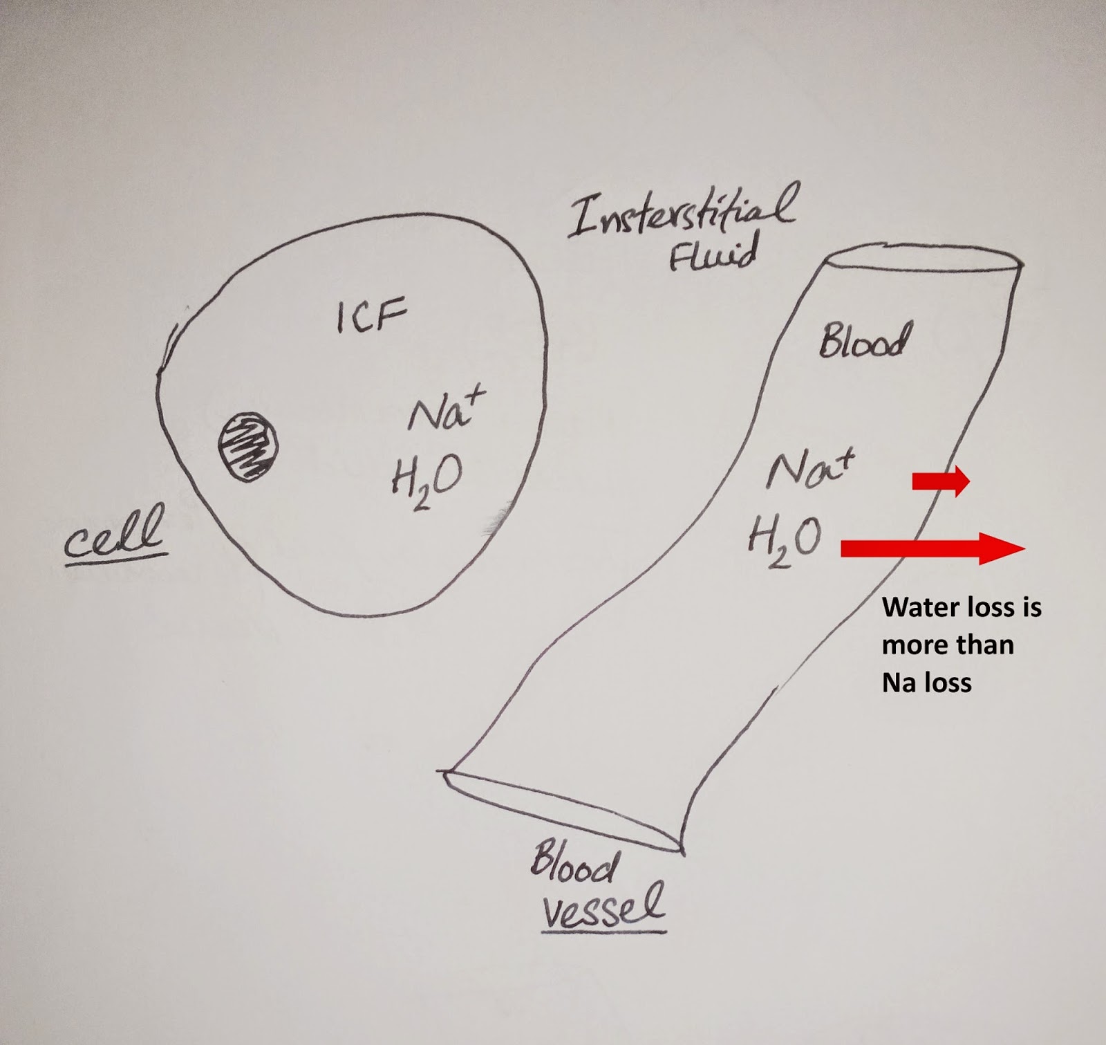 Histology Slides Database: Hypernatremic dehydration physiology