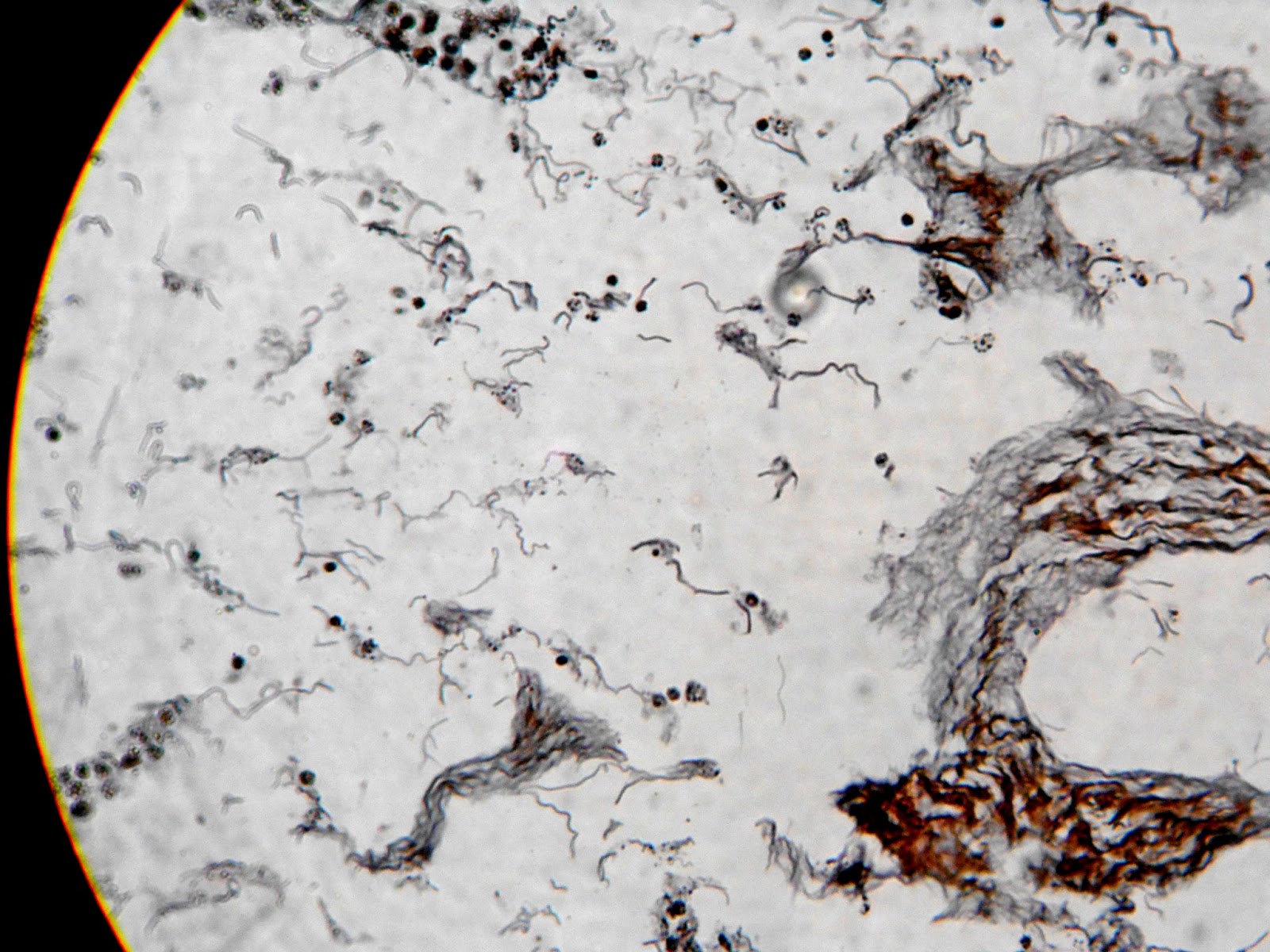 Placas Histologicas : Fibras reticulares