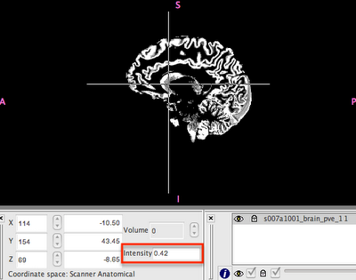 Andy's Brain Blog: FSL Tutorial 8: FAST