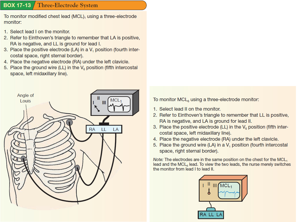 Путь персонального роста: Three-Electrode Systems