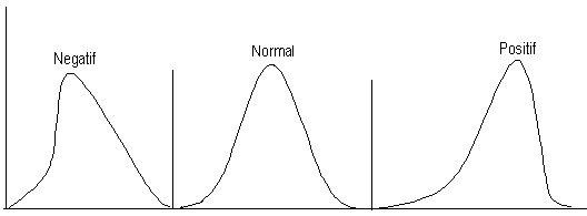 Sekolahku: Kemiringan dan Keruncingan Kurva Distribusi