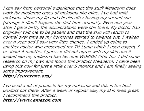 Hyperpigmentation Remedies: Best Treatment For Melasma