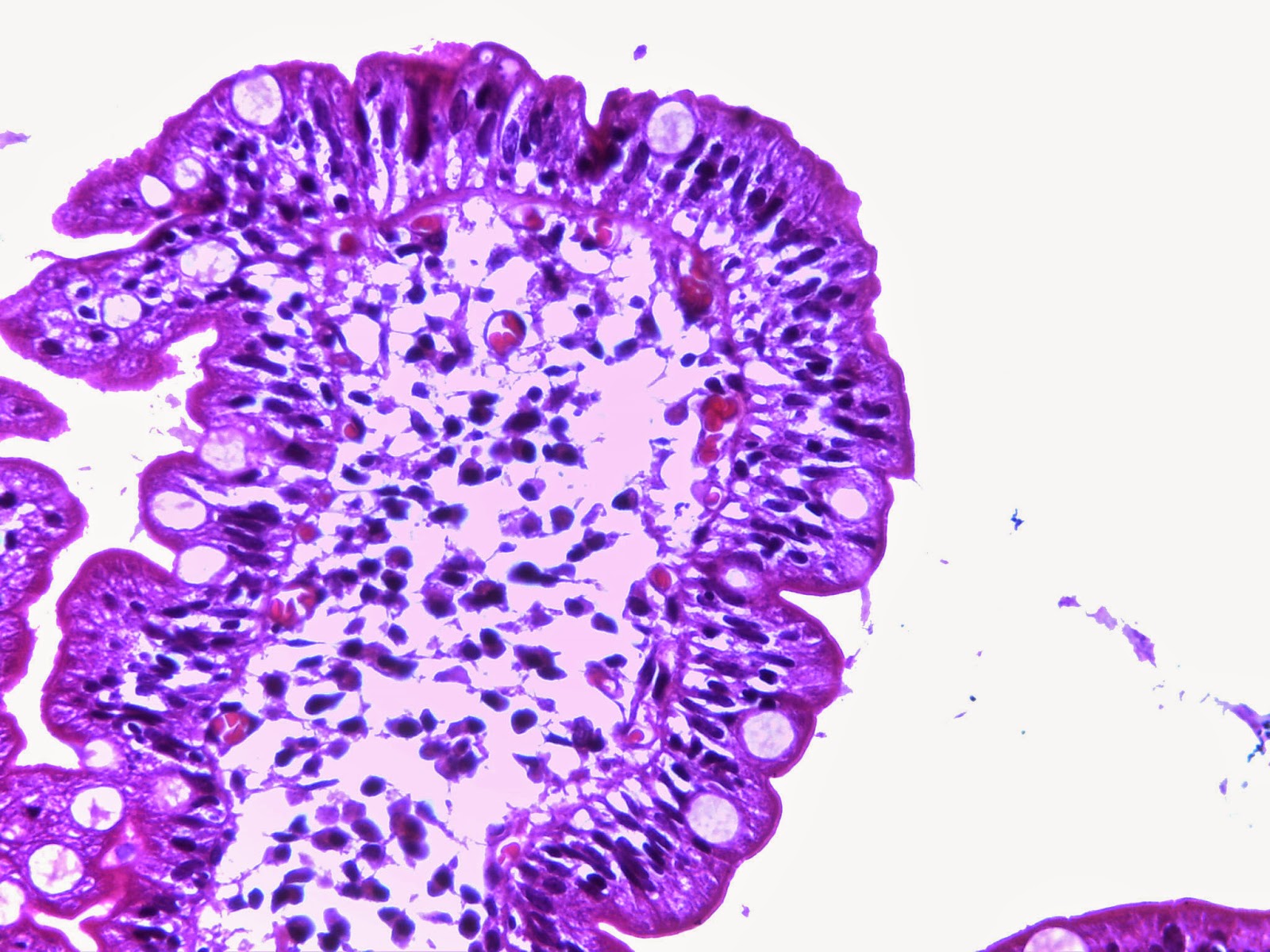 GASTROINTESTINAL AND LIVER HISTOLOGY PATHOLOGY ATLAS: DUODENUM: VILLOUS ...