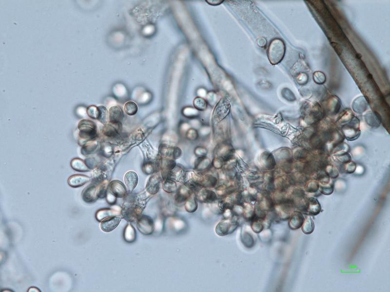 EL MUNDO MICROSCOPICO