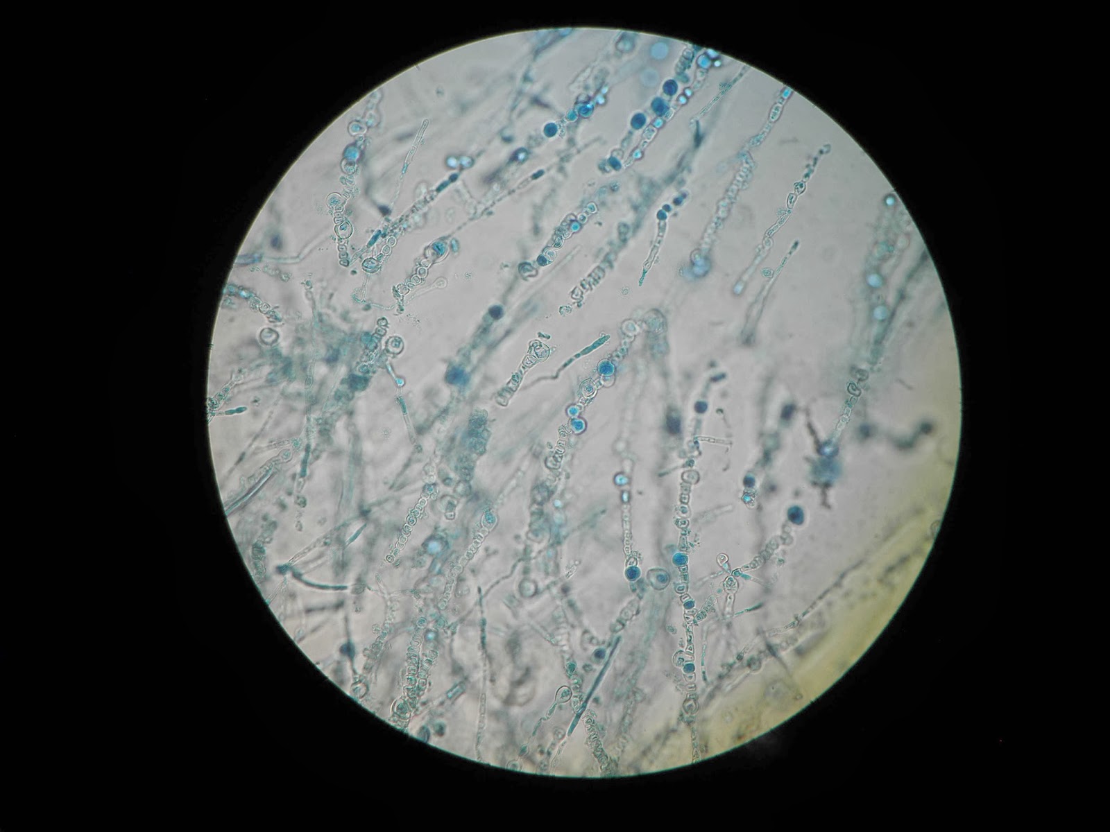 ATLAS MICOLOGIA: TRICHOPHYTON VERRUCOSUM