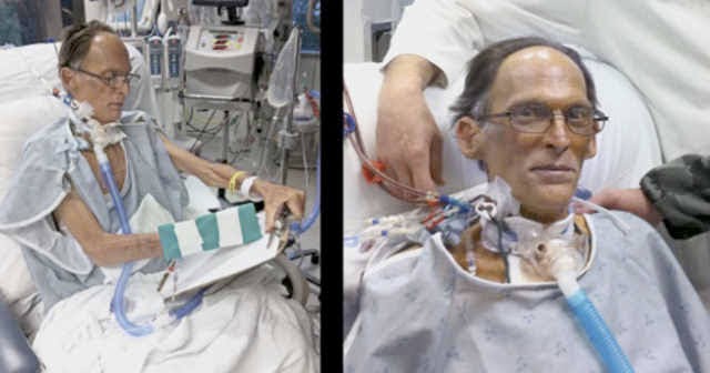 First human head transplant has been carried out on a corpse ...