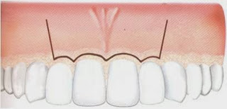 DRA DANIELA CHAVEZ ÉNFASIS CLÍNICO QUIRÚRGICO : SABERES CONCEPTUALES