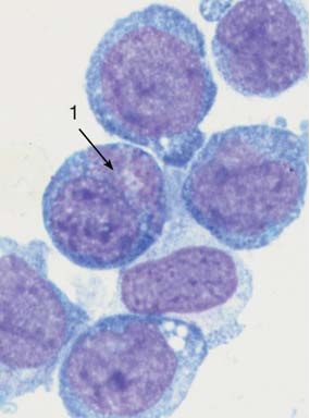 [Haematology] Abnormalities of the White Cell Series | Free Medical Atlas