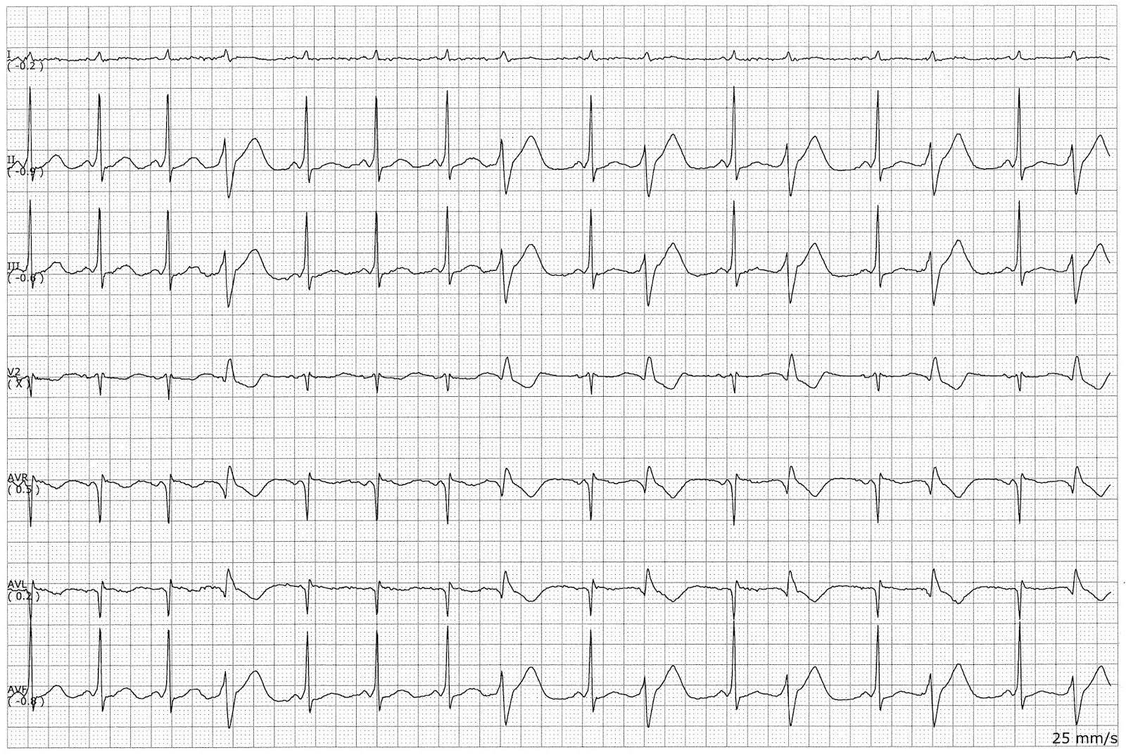 Float Nurse: November 2017