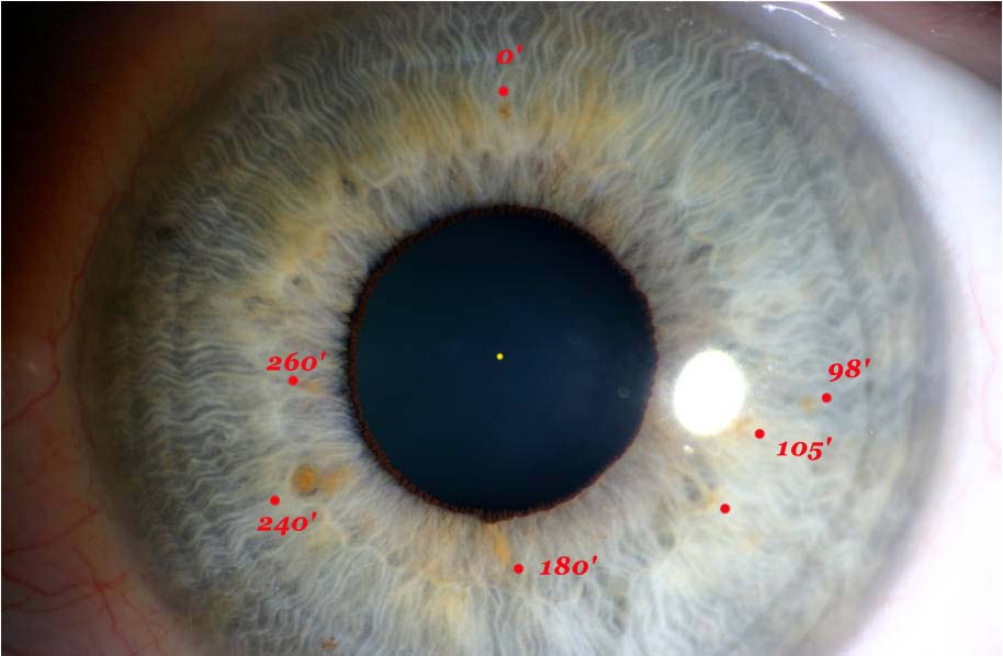 Modern & Multidimensional Iridology: The Colour, Size, Density ...