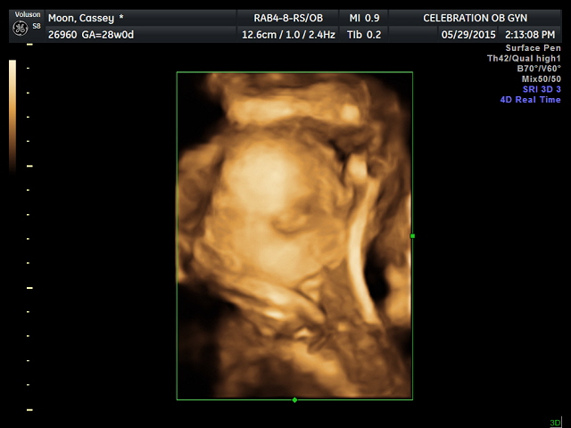 Little Baby Moon: 28 weeks with TWINS!