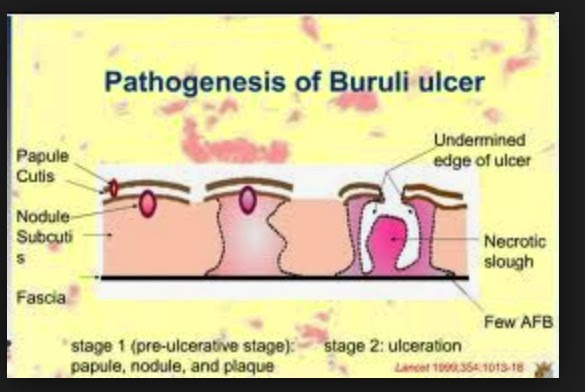 Phage therapy subjects from Sellano town : Is Phage Therapy possible in ...