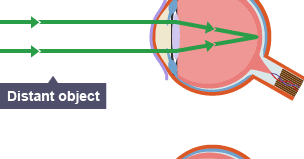 IGCSE Biology: 2.88 Understand the function of the eye in focusing near ...