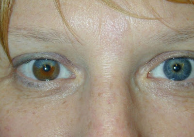 standby life: オッドアイの美女たち Beautiful Girls With odd eye