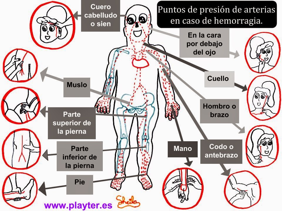 SALUD HOLÍSTICA: Cómo detener una hemorragia externa