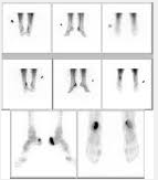 Nuclear Medicine Exams Explained - For The Patient: Nuclear Medicine ...