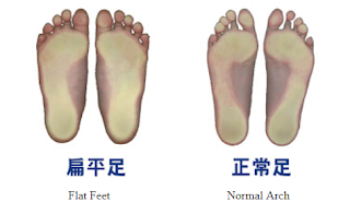 Common Foot Problems In Children ~ Parenting Times