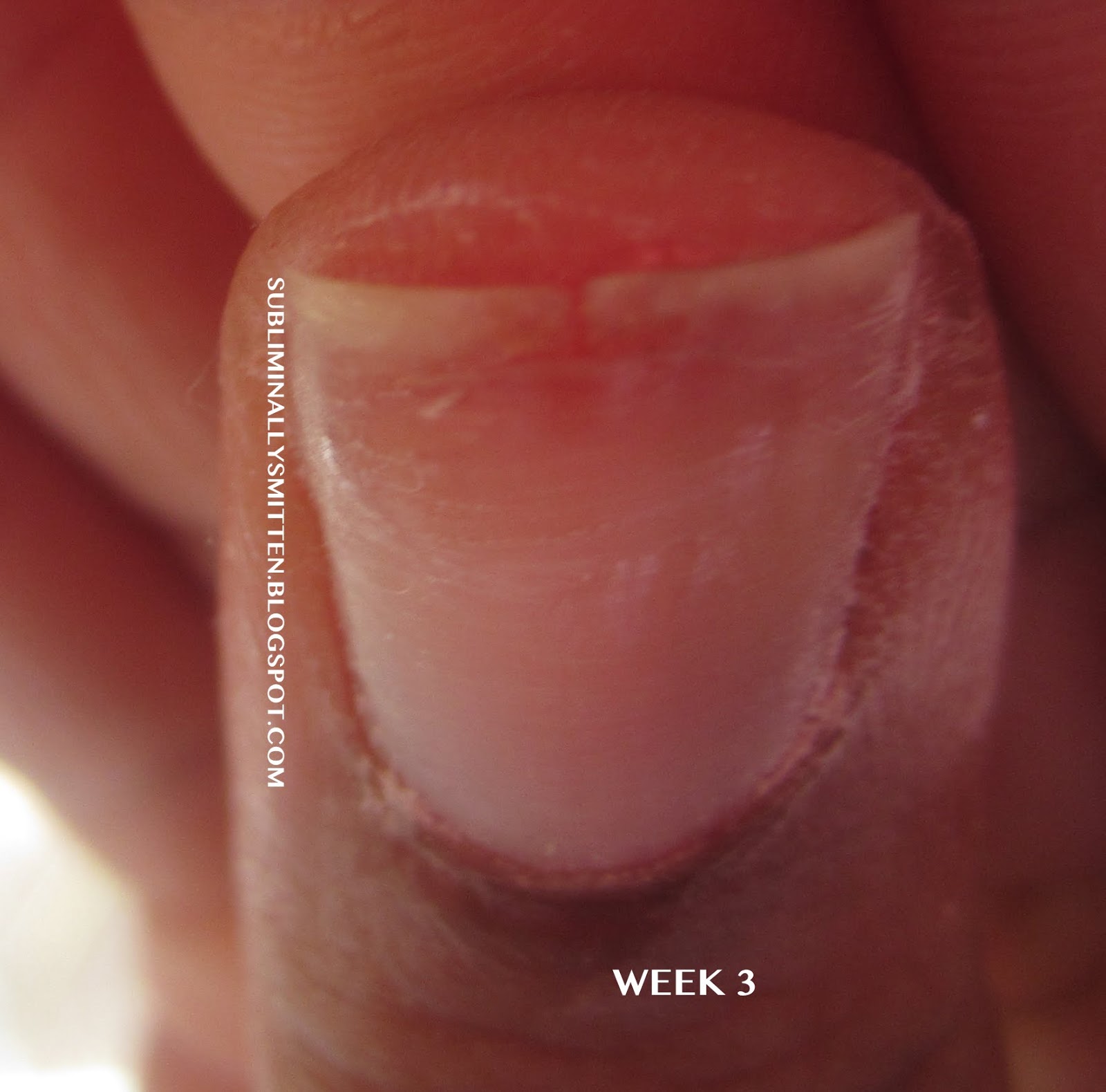 ~~~SubliminallySmitten~~~ : Healthy Nails: The Journey