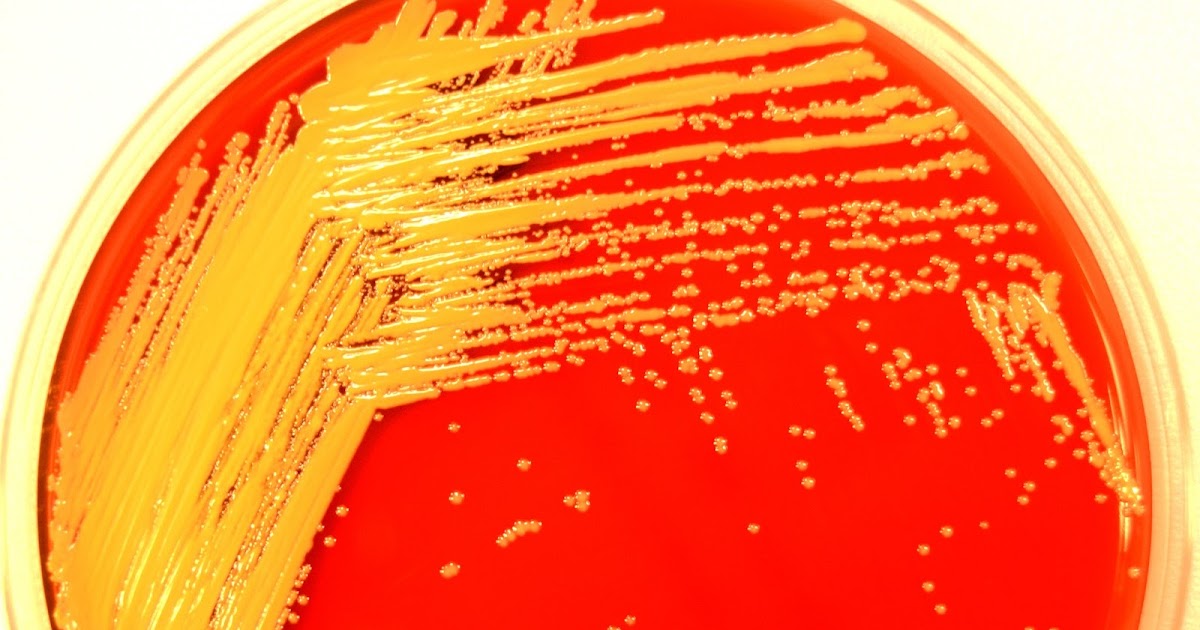 Medical Laboratory and Biomedical Science: Golden bacterium ...