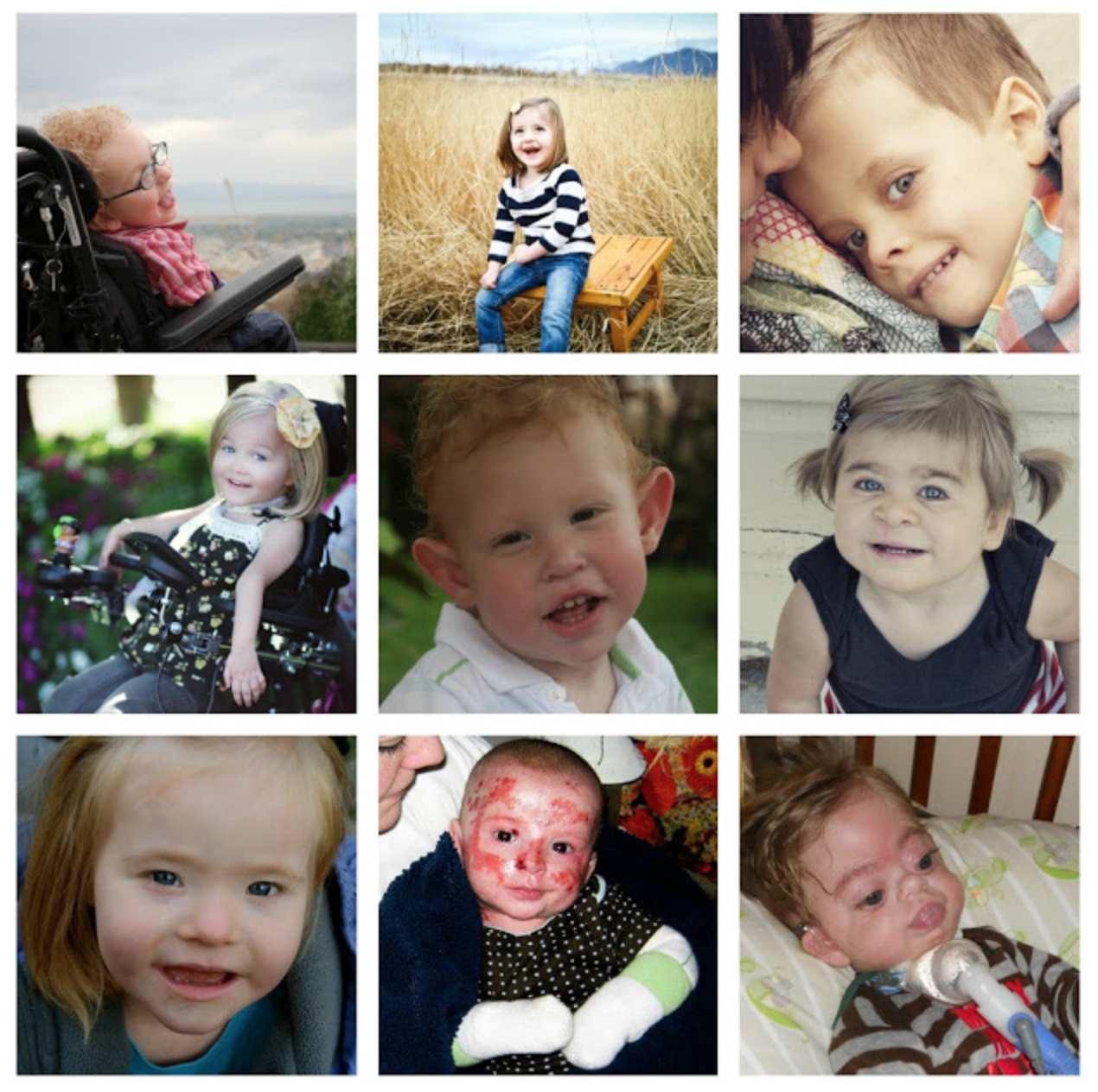 Disability+Differences Spotlight » This Little Miggy