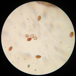 Misidentifying Fungi: June 2017