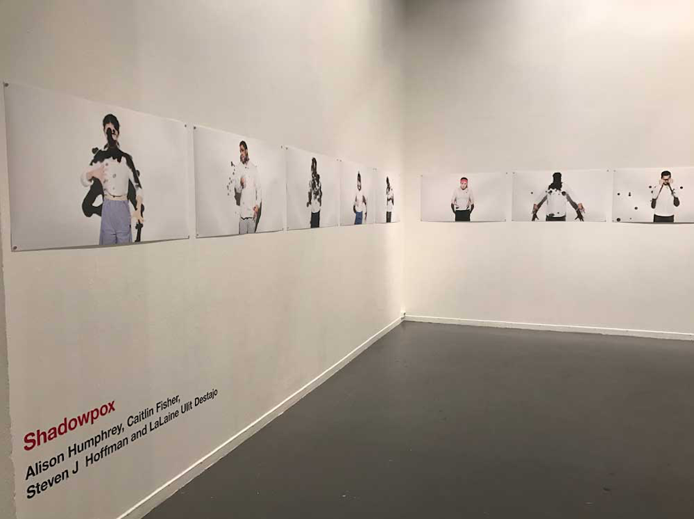 Alison Humphrey: The Lancet and Canadian Art review Shadowpox: The ...