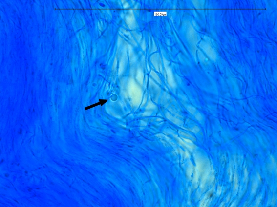 Fun With Microbiology (What's Buggin' You?): Sarocladium kiliense