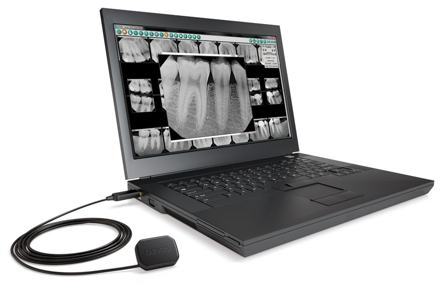 CLINICA DENTAL ANNA BALLESTER: ¿CUÁLES SON LAS VENTAJAS DE LAS ...