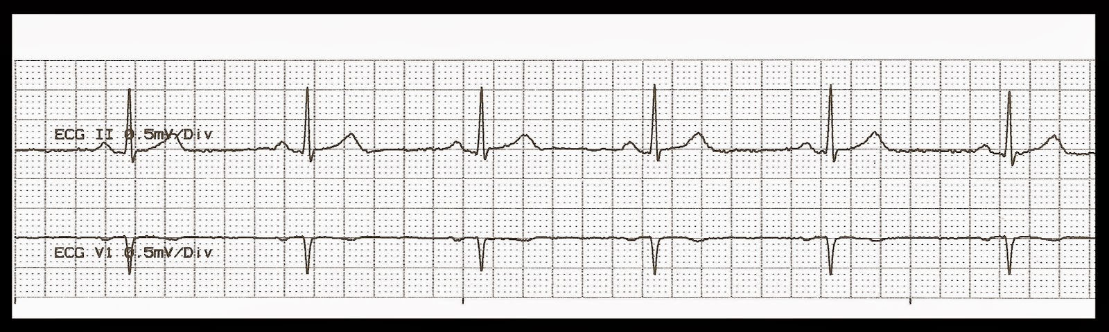 Practice EKG Strips 403