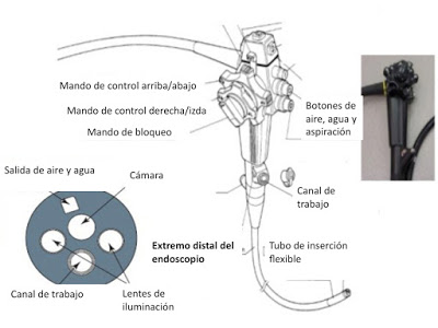 cuidadosdeinstrumentalquirurgico: ENDOSCOPIOS RIGIDOS Y FLEXIBLES