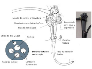 cuidadosdeinstrumentalquirurgico: ENDOSCOPIOS RIGIDOS Y FLEXIBLES