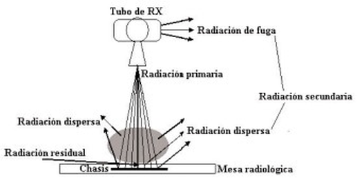 Radiología e Imagen para el Diagnóstico: Radiación Dispersa en los ...