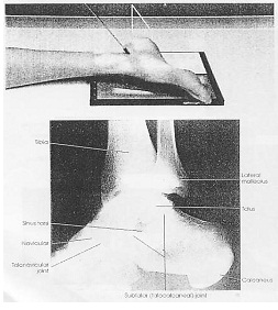 Teknik Radiograf: TEKNIK RADIOGRAFI CALCANEUS