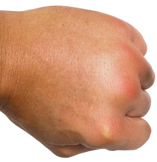 The Huffing: signs that your hands reveal your health status