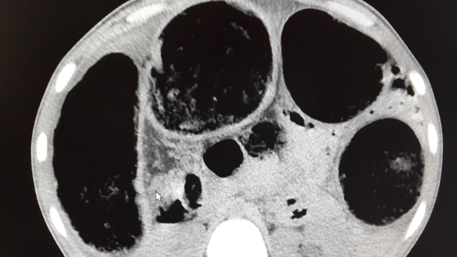 EL RINCÓN DE LA MEDICINA INTERNA. juanpedromacaluso@yahoo.com.ar ...