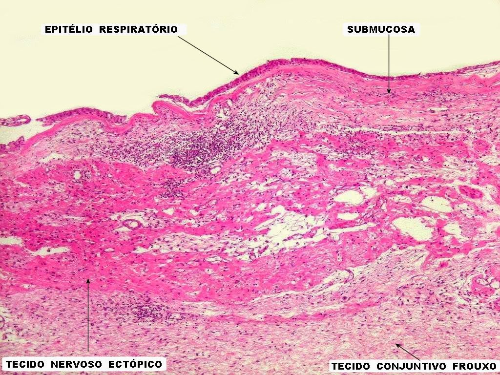 Ciências do CECB: Tipos de mucosas humanas