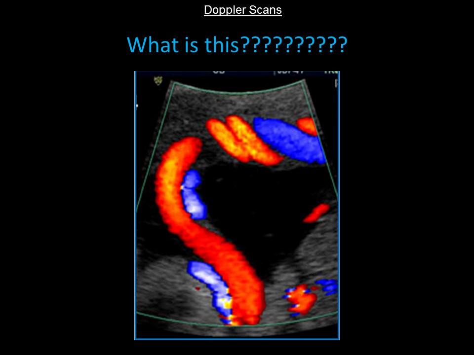 Mr Lloyd's Interactive Board: Doppler Effect, ultrasound, medical imaging