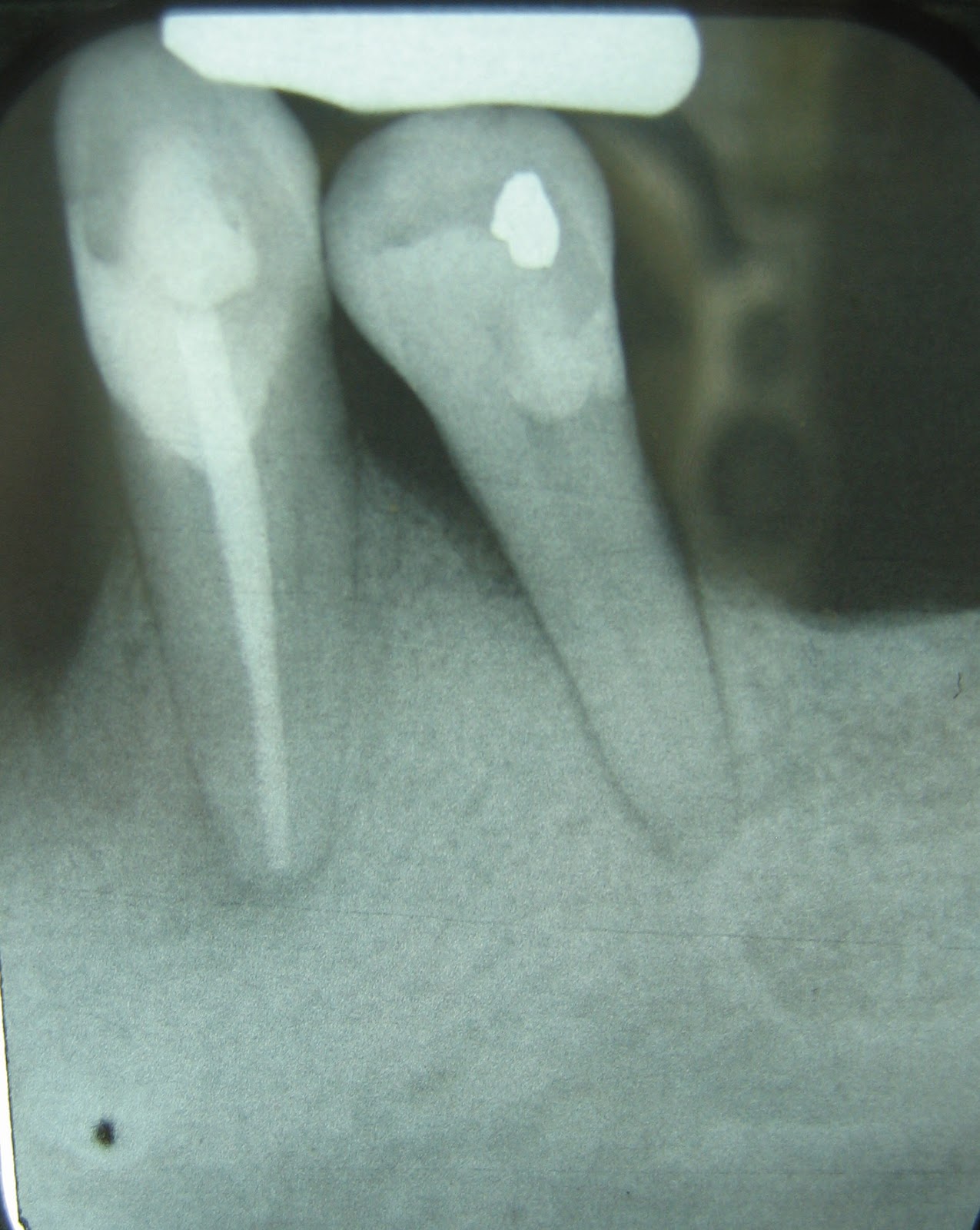 MEDICAL PHOTOGRAPHY AND VIDEOS, MEDICAL PHOTOGRAPHY: TOOTH DISEASE ...